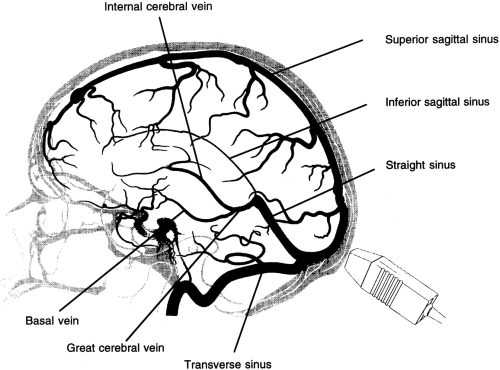 Great cerebral vein
