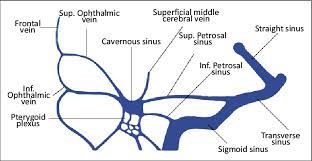 Cavernous sinus