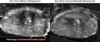 Microultrasonography